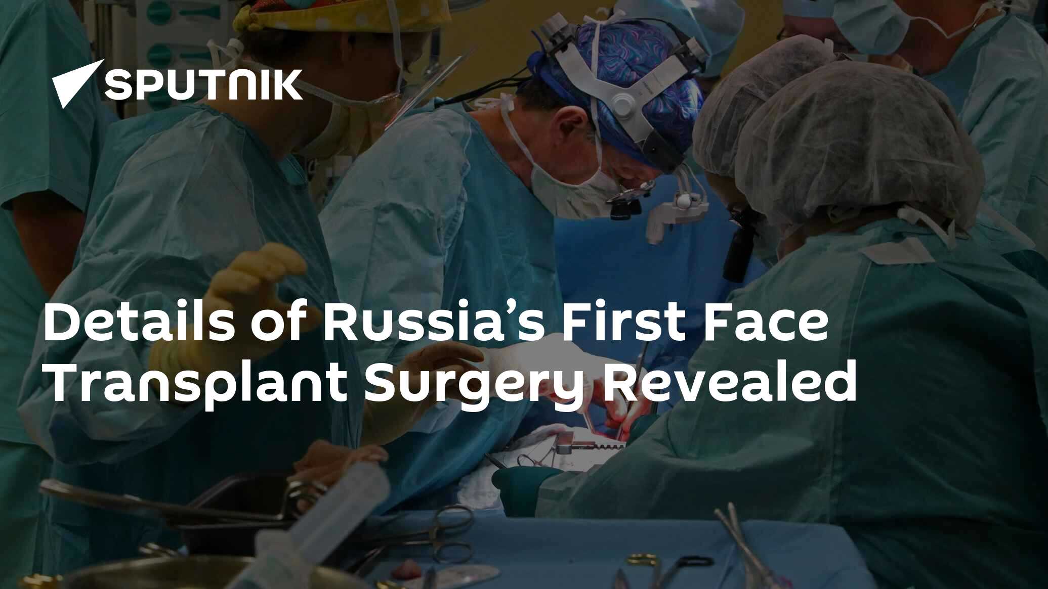 Details of Russia’s First Face Transplant Surgery Revealed - 27.11.2015 ...