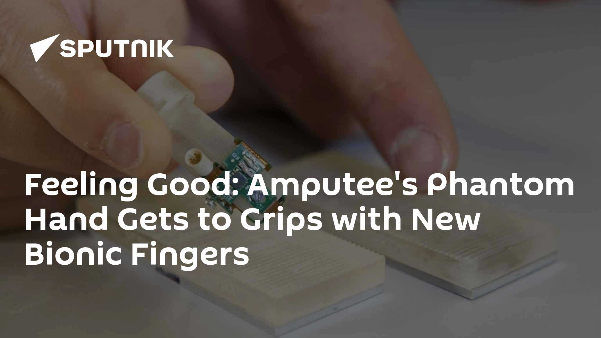 Feeling Good: Amputee's Phantom Hand Gets to Grips with New Bionic ...