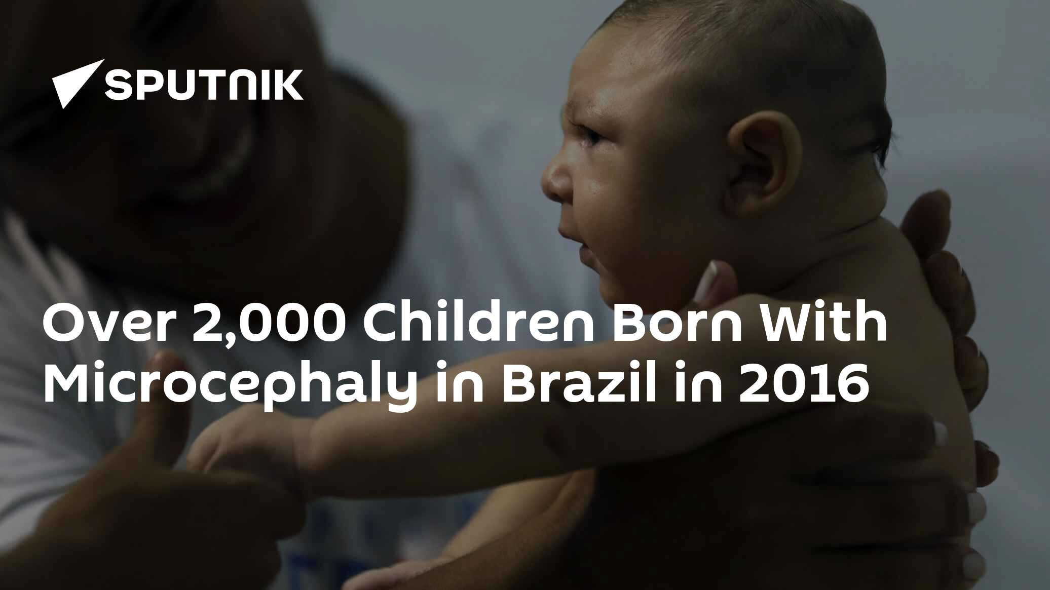 Over 2,000 Children Born With Microcephaly in Brazil in 2016 - 17.10. ...