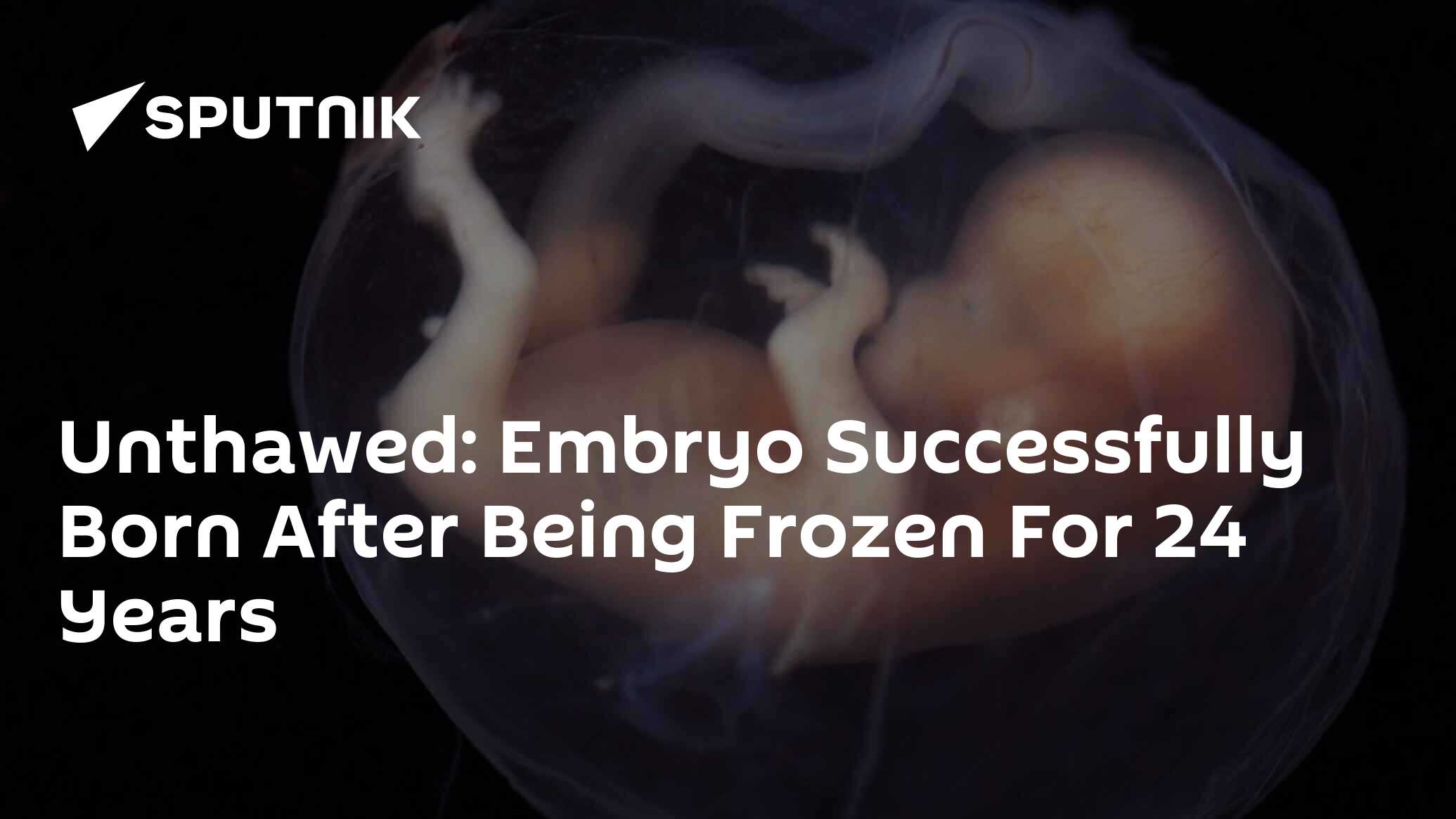 Unthawed: Embryo Successfully Born After Being Frozen For 24 Years - 20 ...