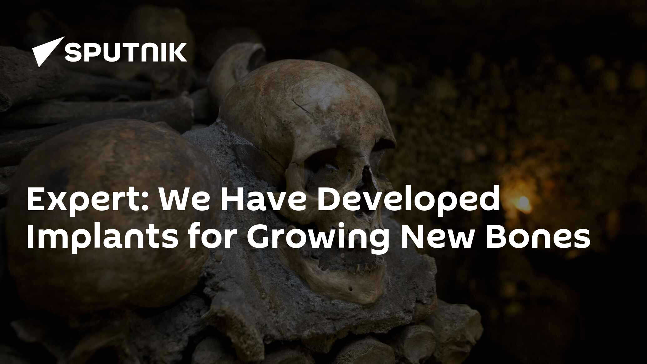 Expert: We Have Developed Implants for Growing New Bones - 27.03.2018 ...