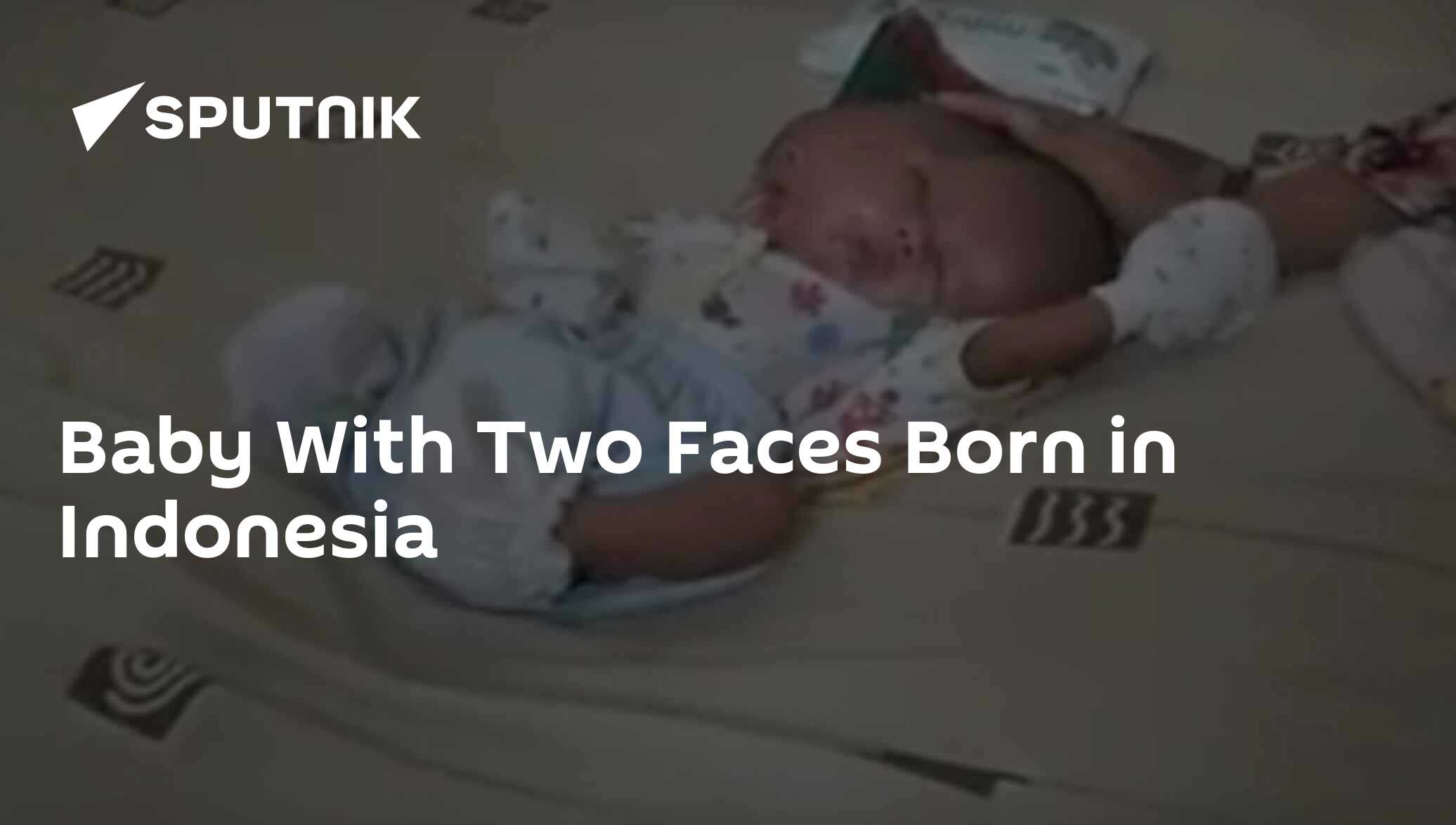 Baby With Two Faces Born in Indonesia - 25.07.2018, Sputnik International