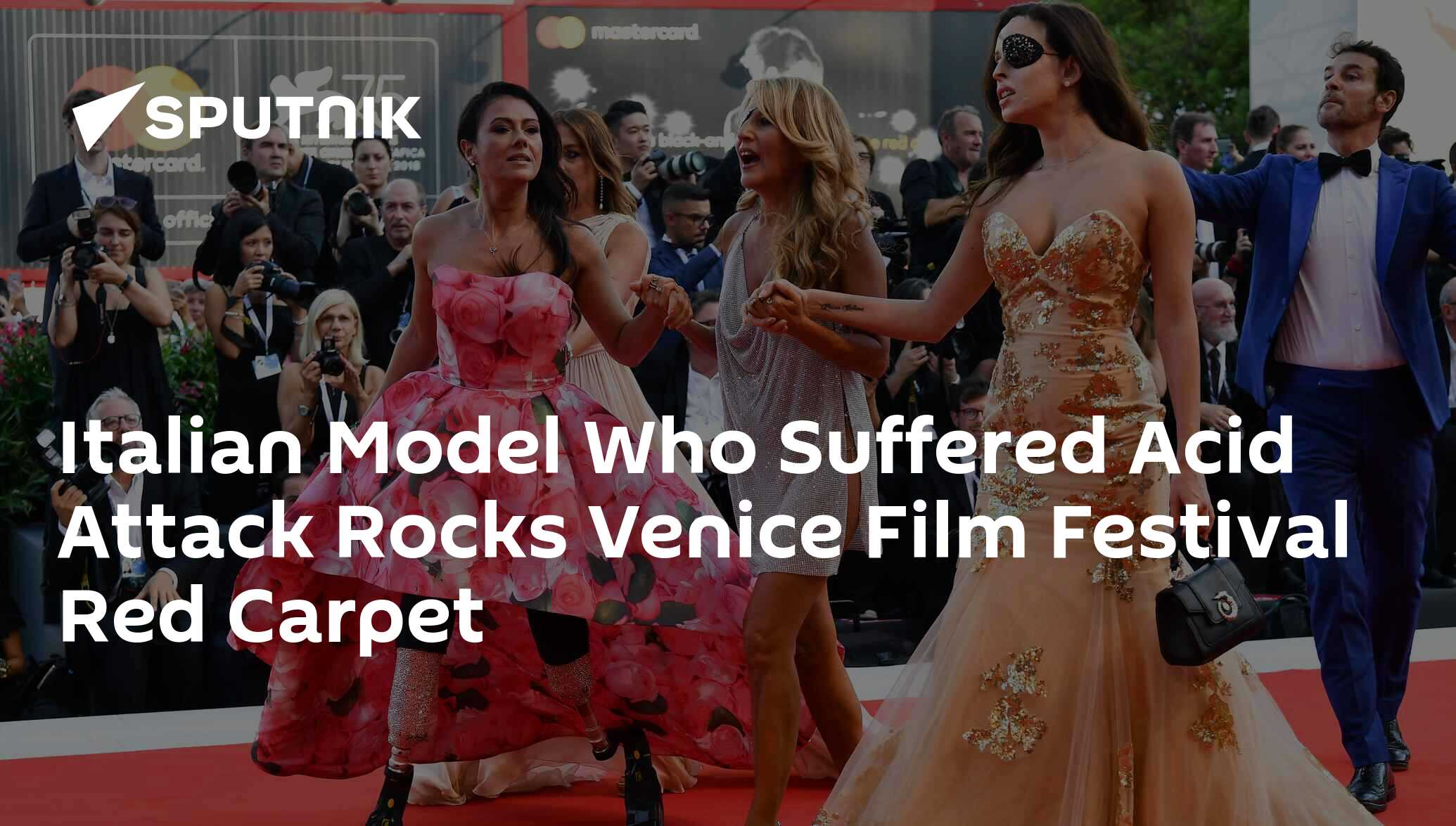 Italian Model Who Suffered Acid Attack Rocks Venice Film Festival Red ...