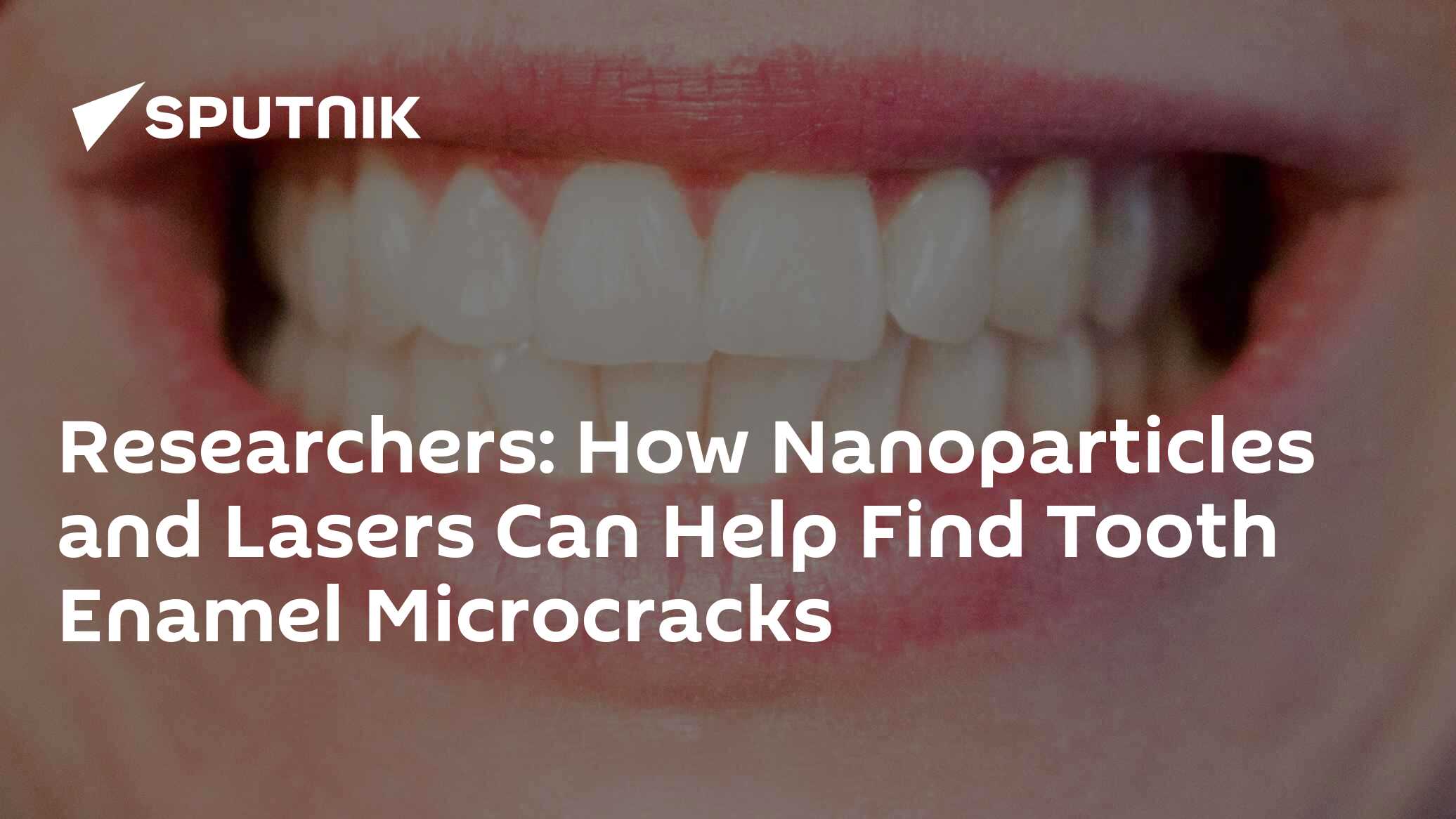 Researchers: How Nanoparticles and Lasers Can Help Find Tooth Enamel ...