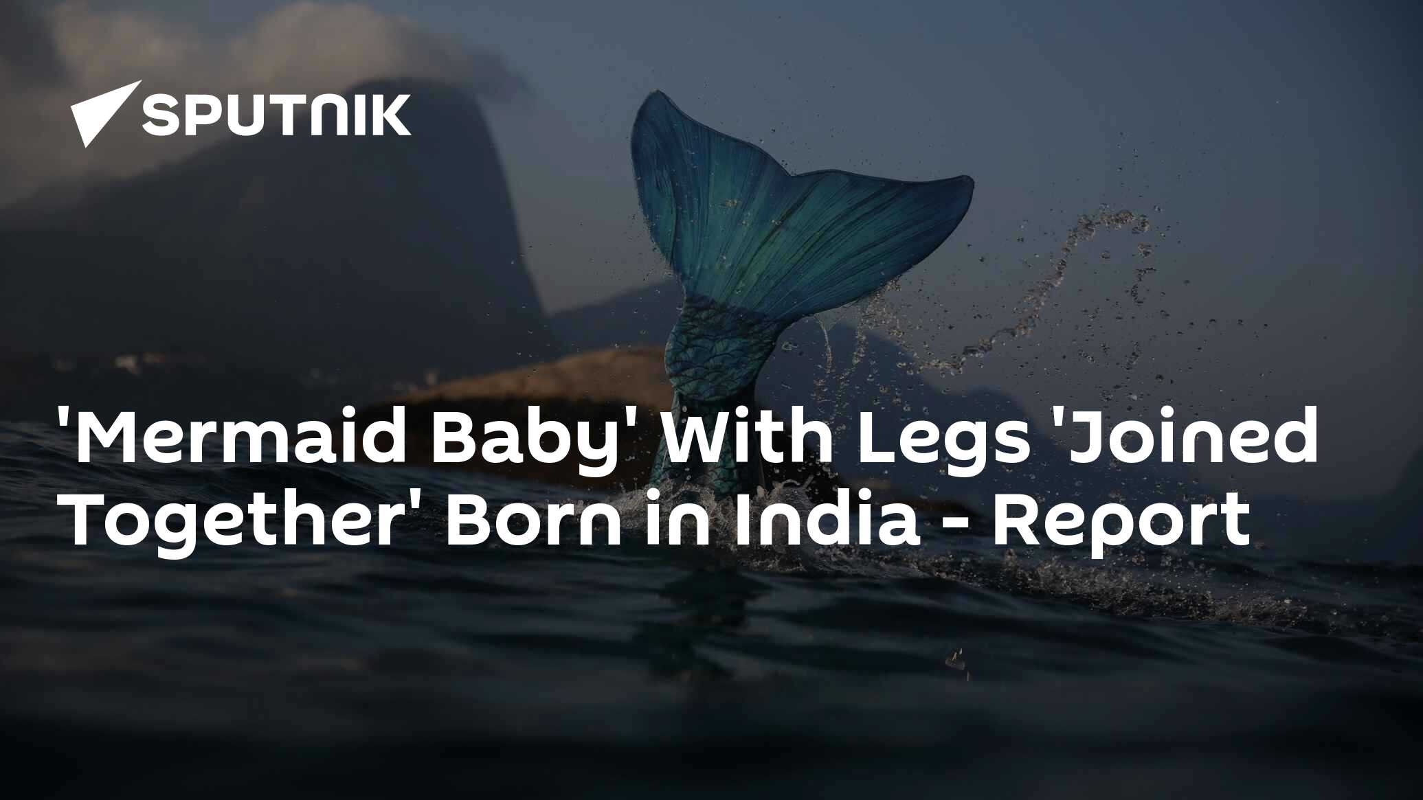 'Mermaid Baby' With Legs 'Joined together' Born in India - Report