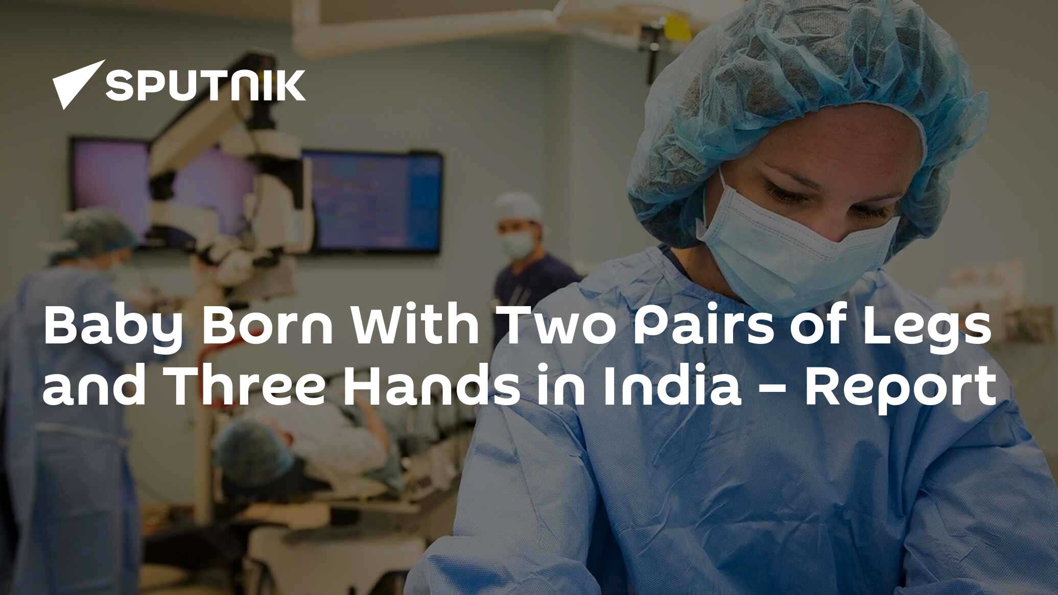 Baby Born With Two Pairs of Legs and Three Hands in India – Report