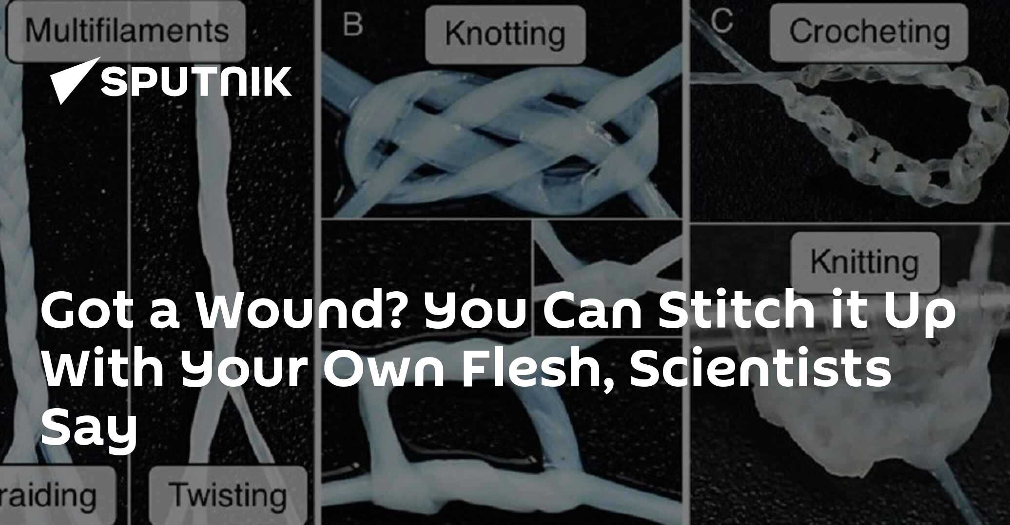Got a Wound? You Can Stitch it Up With Your Own Flesh, Scientists Say