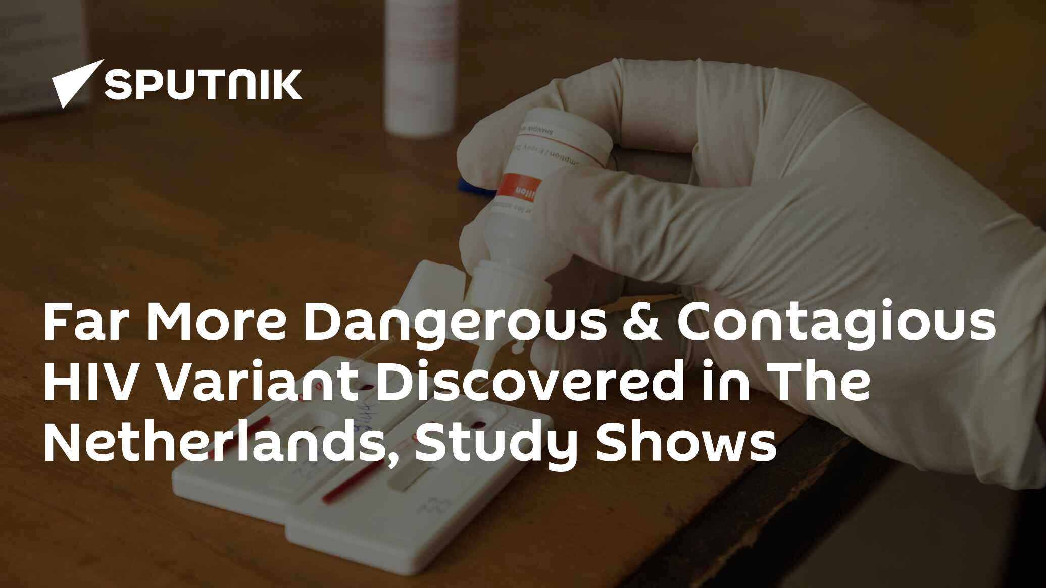 Far More Dangerous & Contagious HIV Variant Discovered in The ...