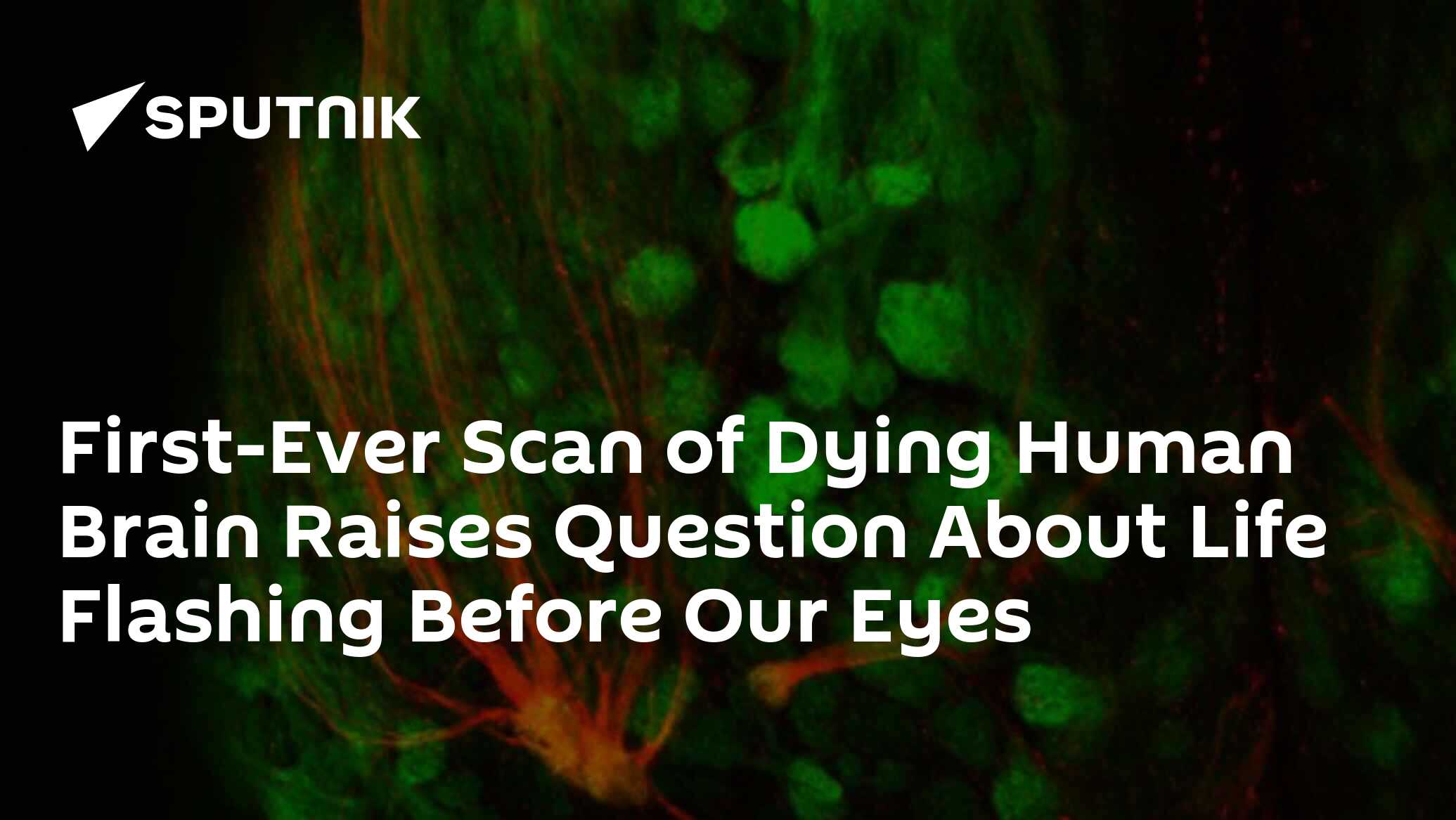 World’s First Scan of Dying Human Brain Sheds Light on What Happens ...
