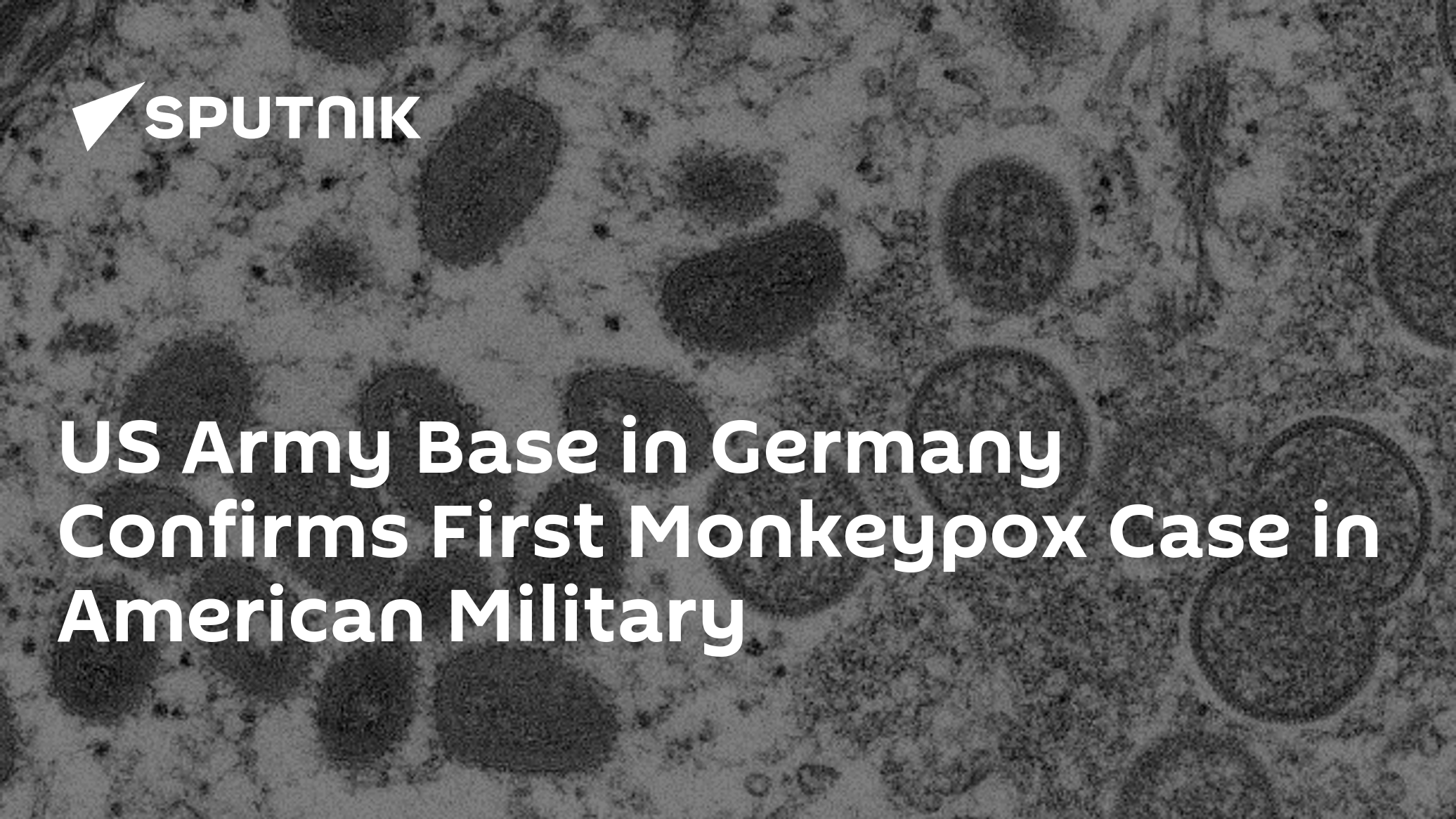 US Army Base in Germany Confirms First Monkeypox Case in American ...
