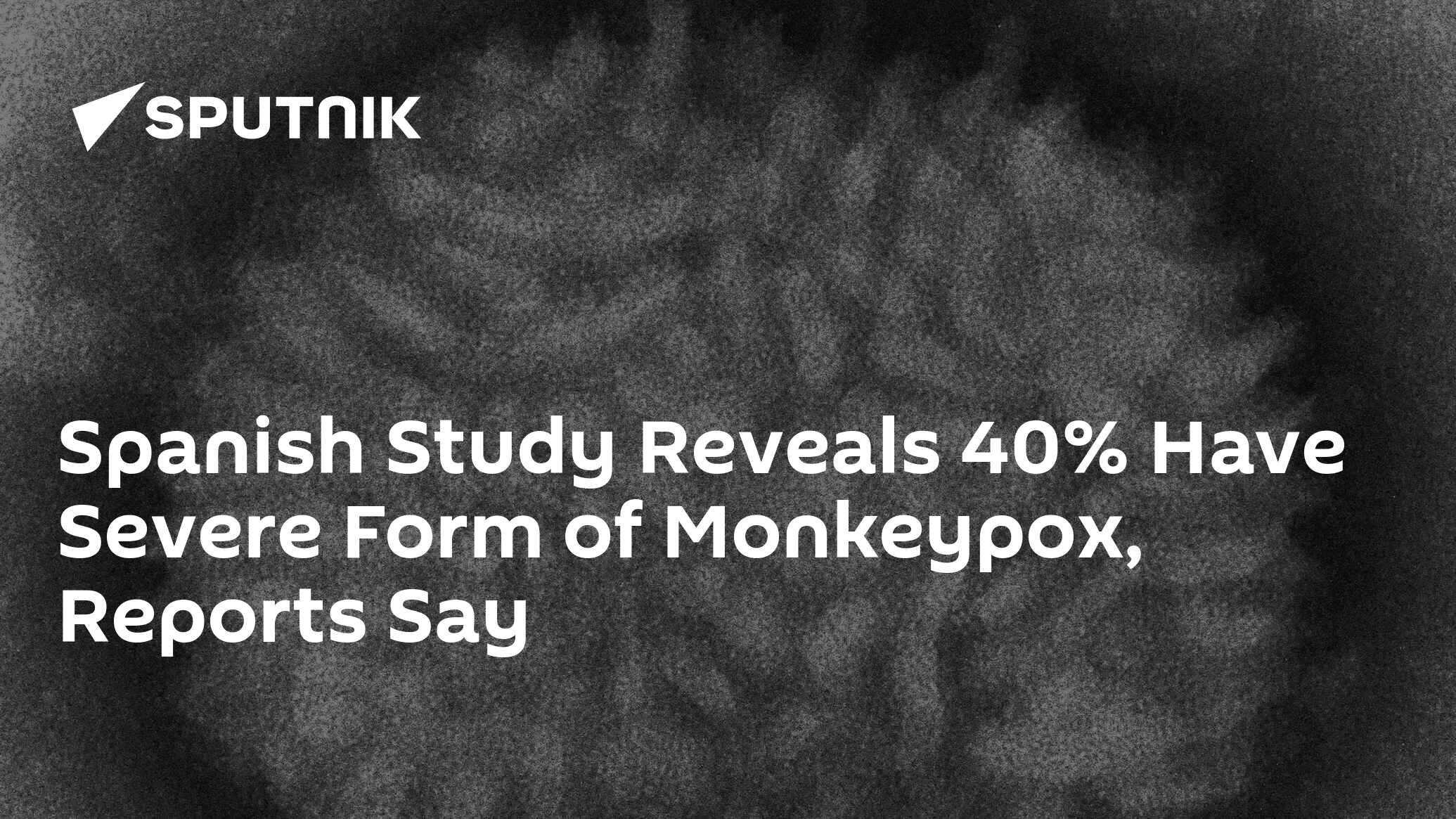 Spanish Study Reveals 40% Have Severe Form of Monkeypox, Reports Say ...