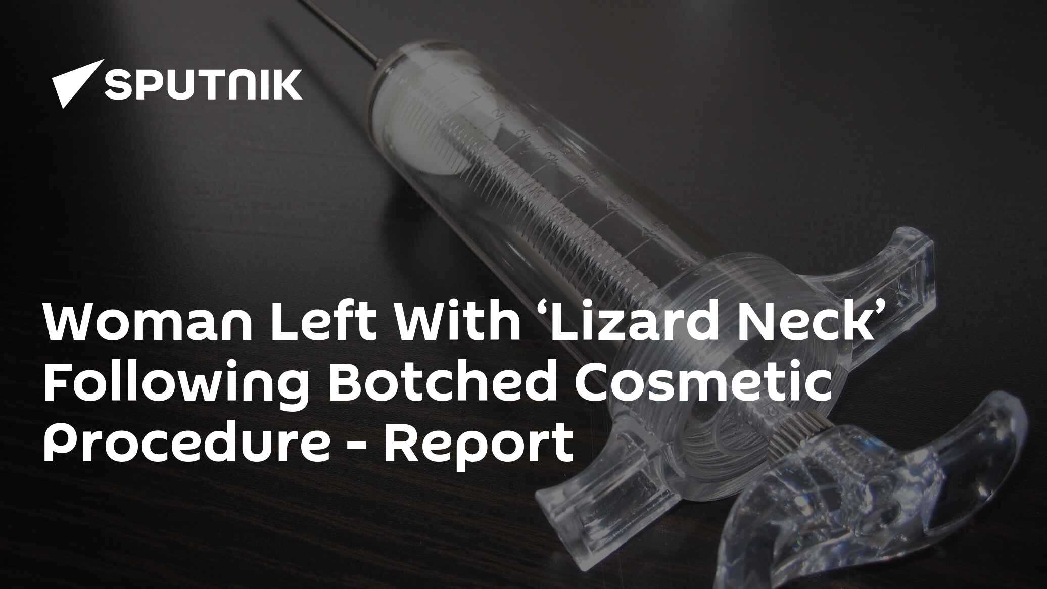 Woman Left With ‘Lizard Neck’ Following Botched Cosmetic Procedure ...