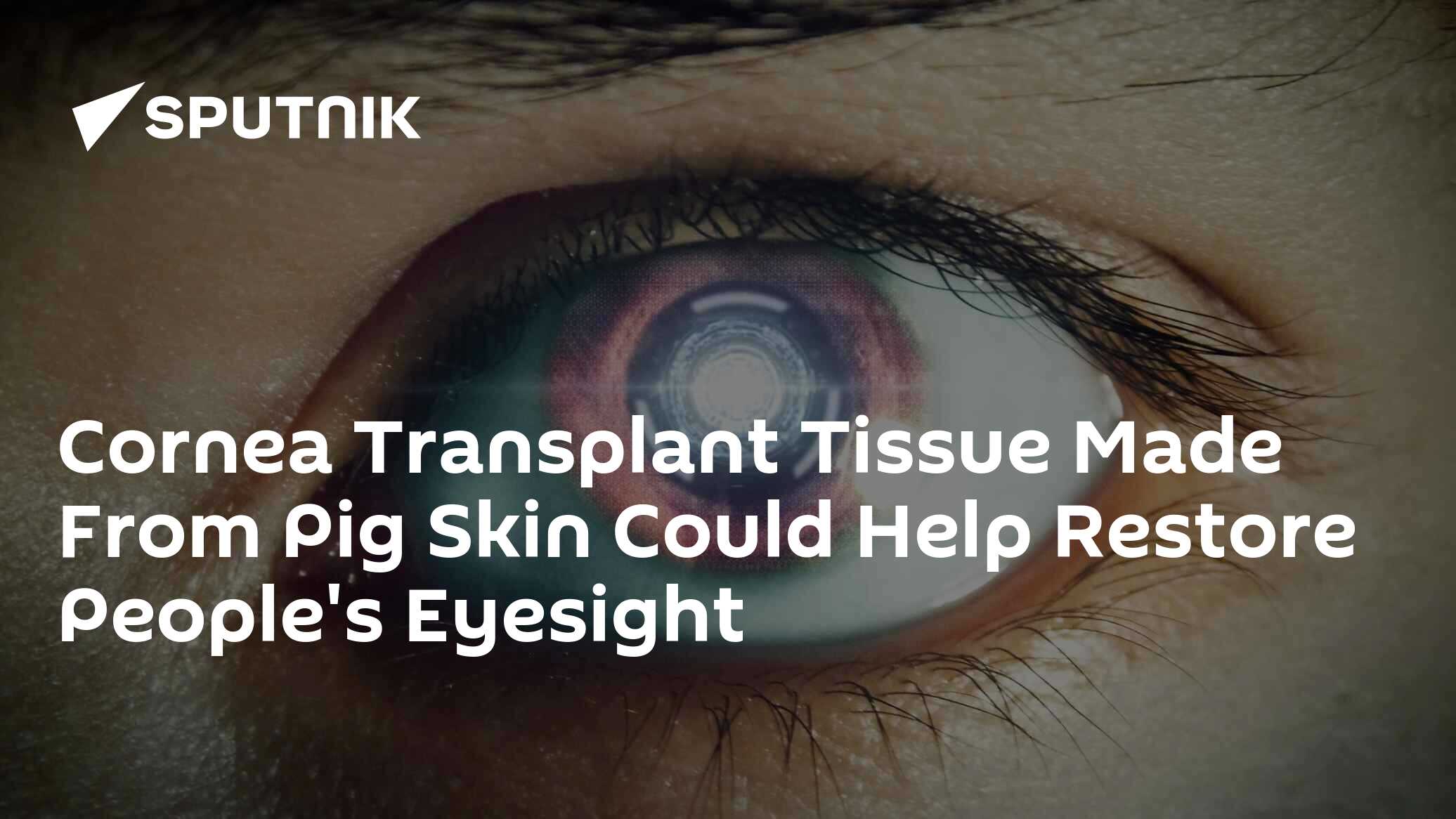 Cornea Transplant Tissue Made From Pig Skin Could Help Restore People's ...