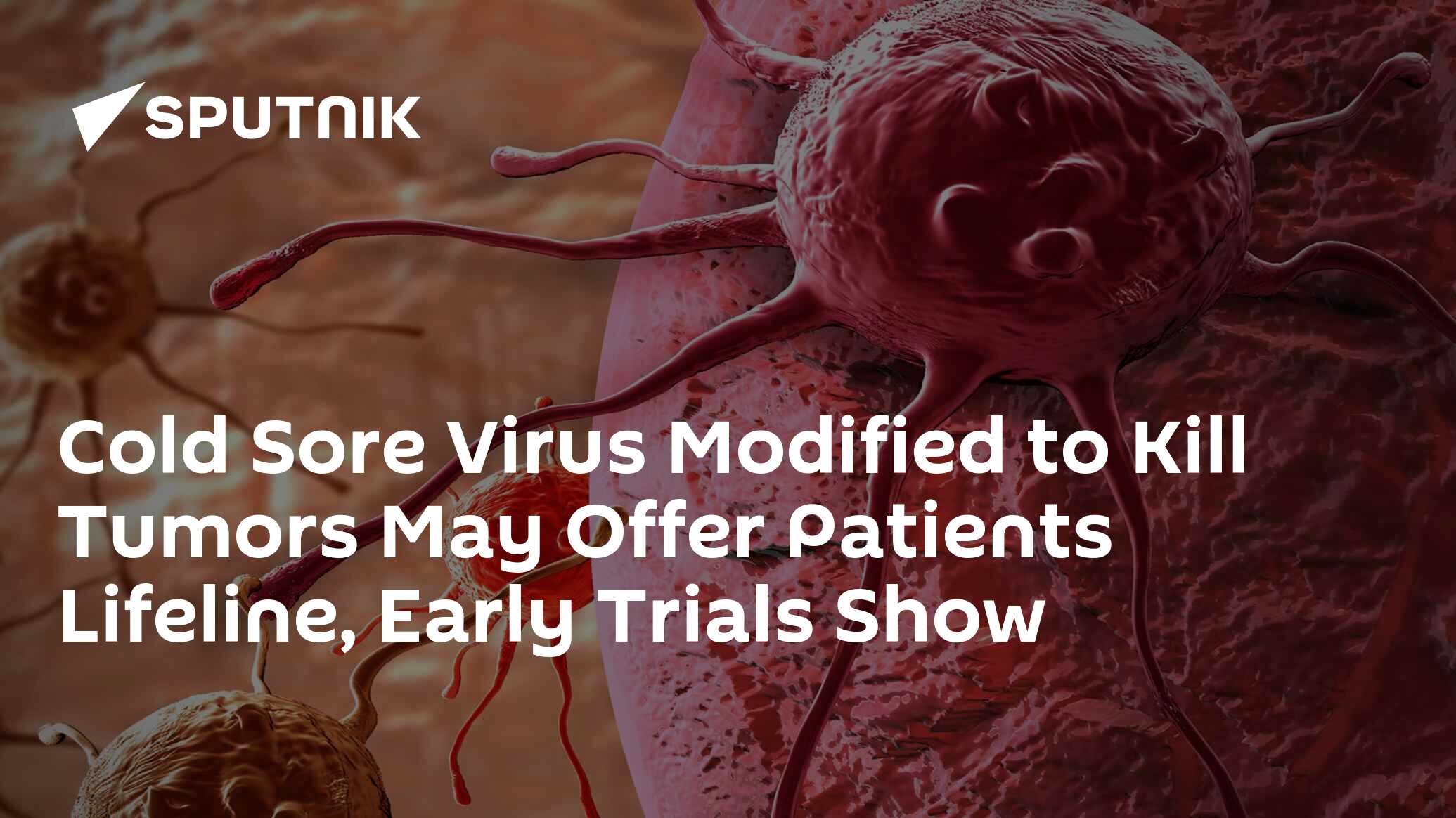 Cold Sore Virus Modified to Kill Tumors May Offer Patients Lifeline ...