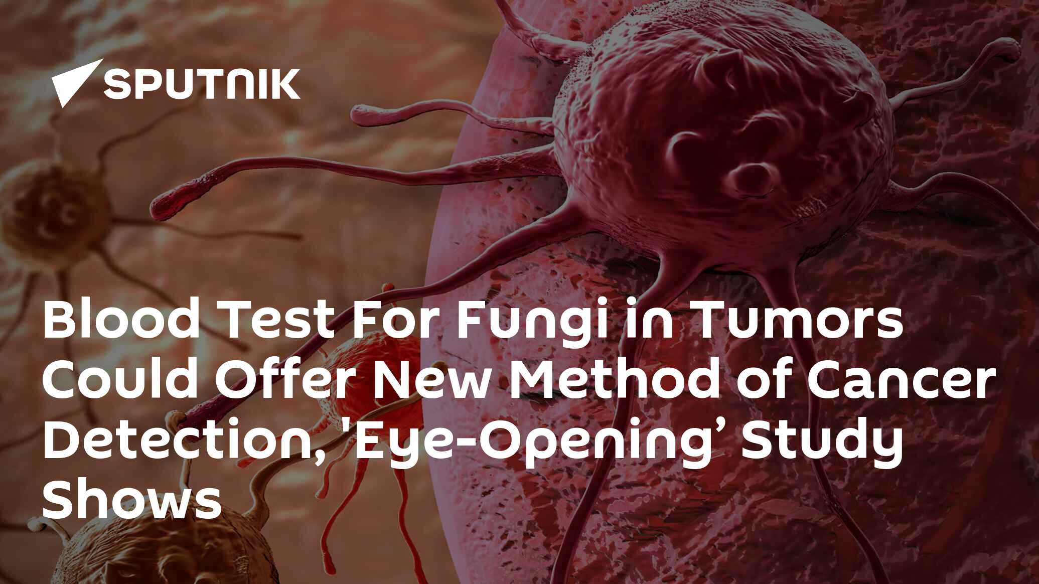 Blood Test For Fungi in Tumors Could Offer New Method of Cancer ...