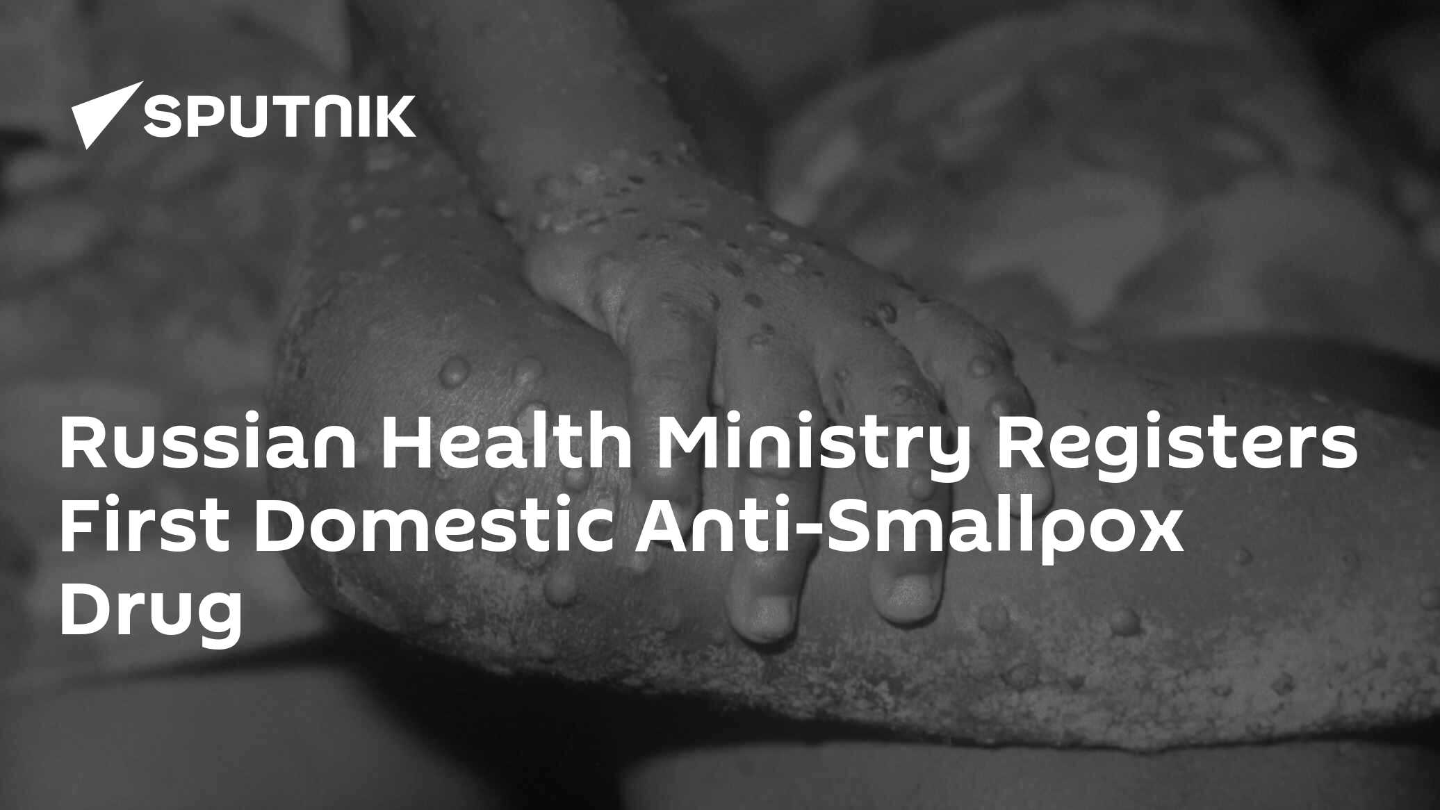 Russian Health Ministry Registers First Domestic Anti-Smallpox Drug ...