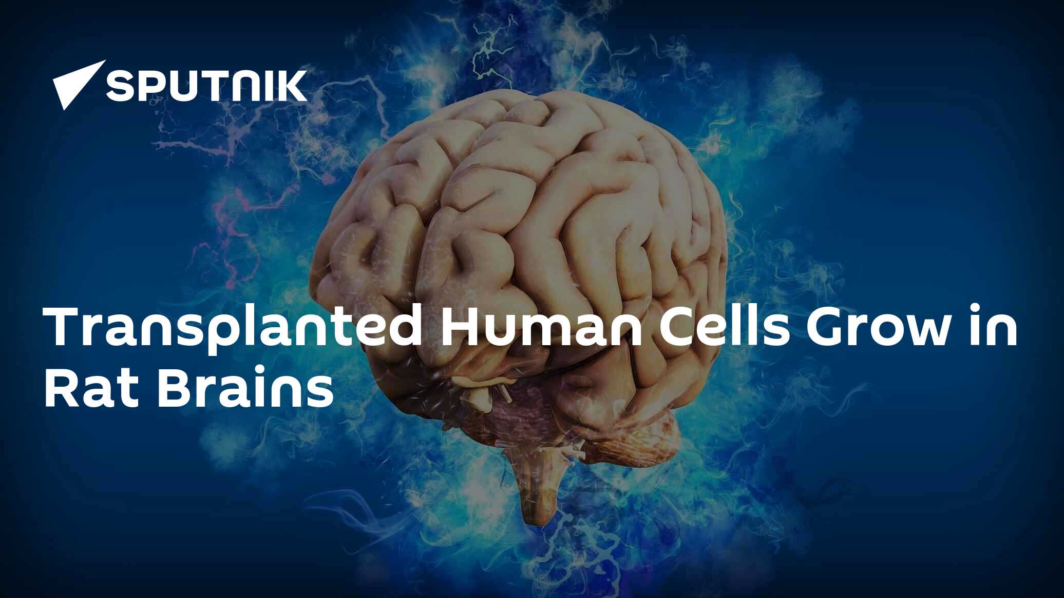 Transplanted Human Cells Grow in Rat Brains - 12.10.2022, Sputnik ...