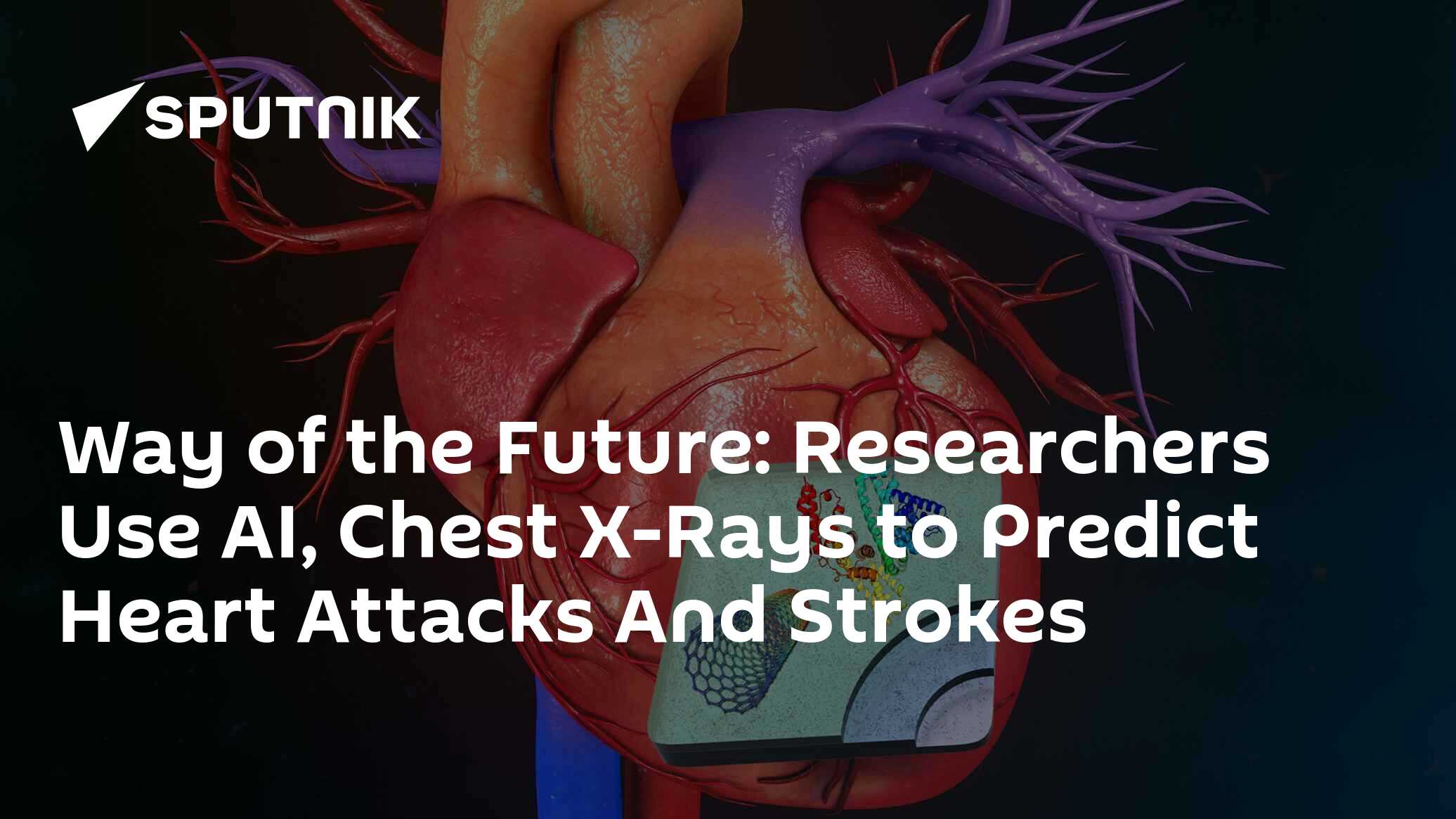 Way of the Future: Researchers Use AI, Chest X-Rays to Predict Heart ...