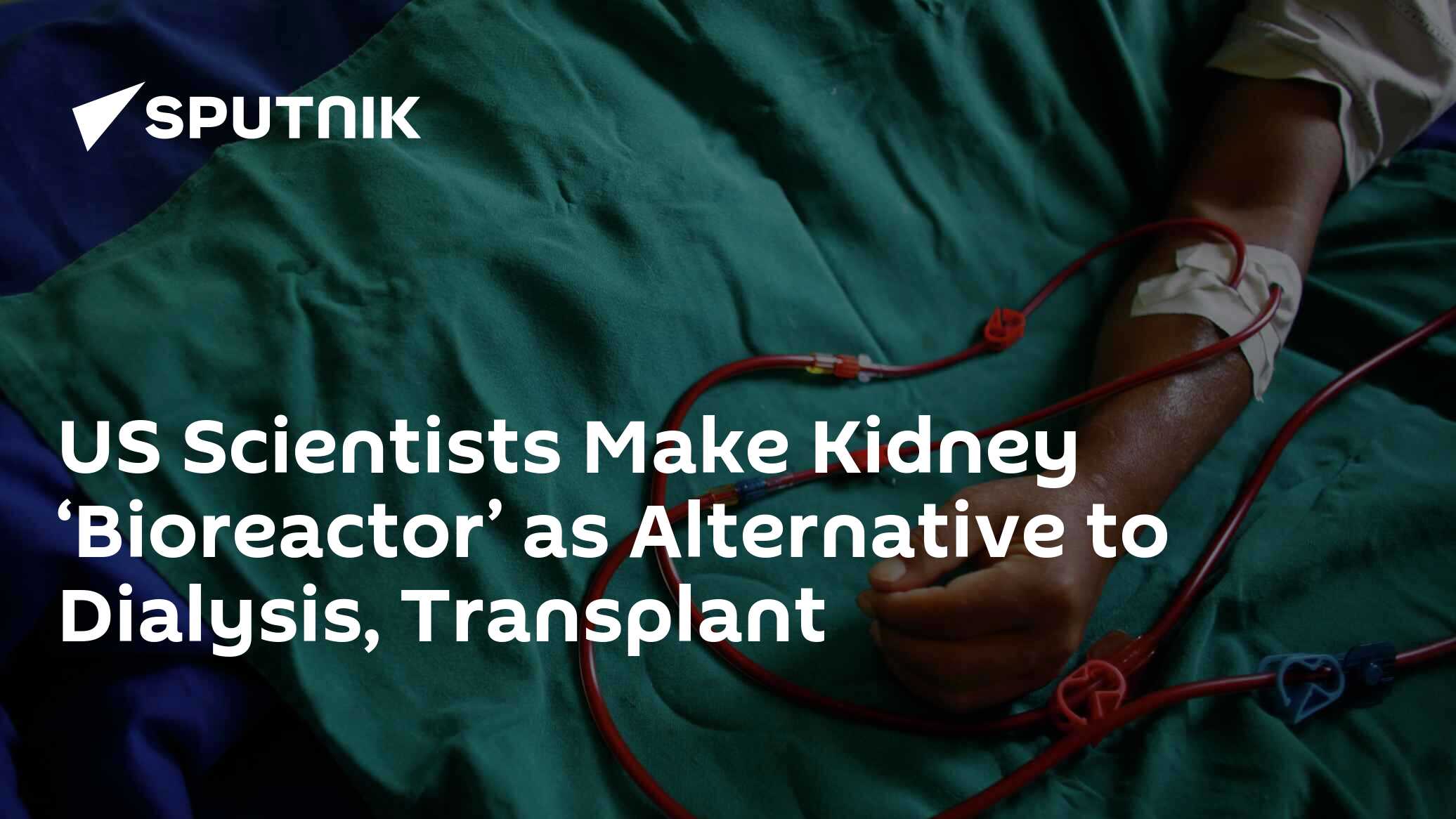 US Scientists Make Kidney ‘Bioreactor’ as Alternative to Dialysis ...