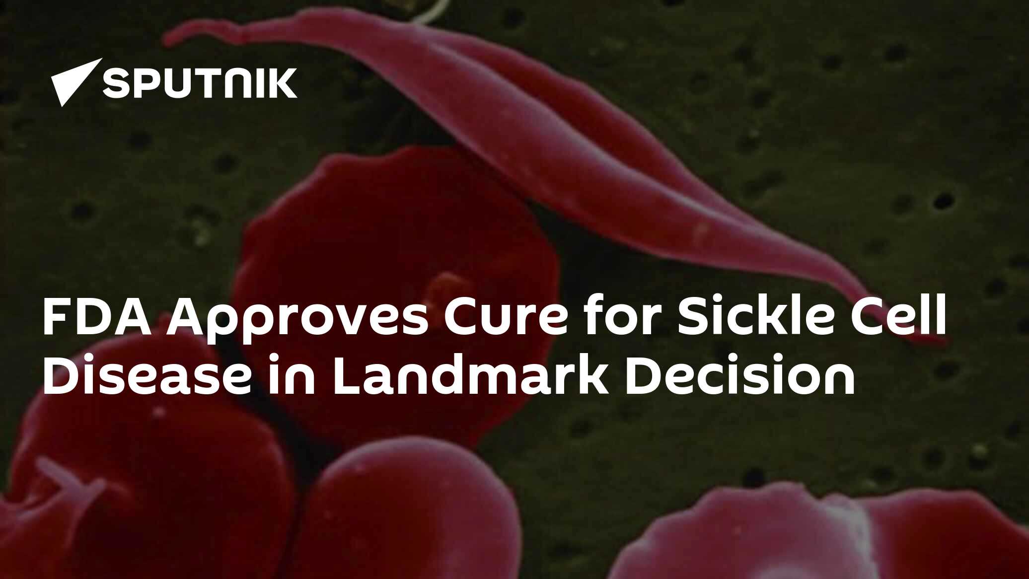 FDA Approves Cure for Sickle Cell Disease in Landmark Decision