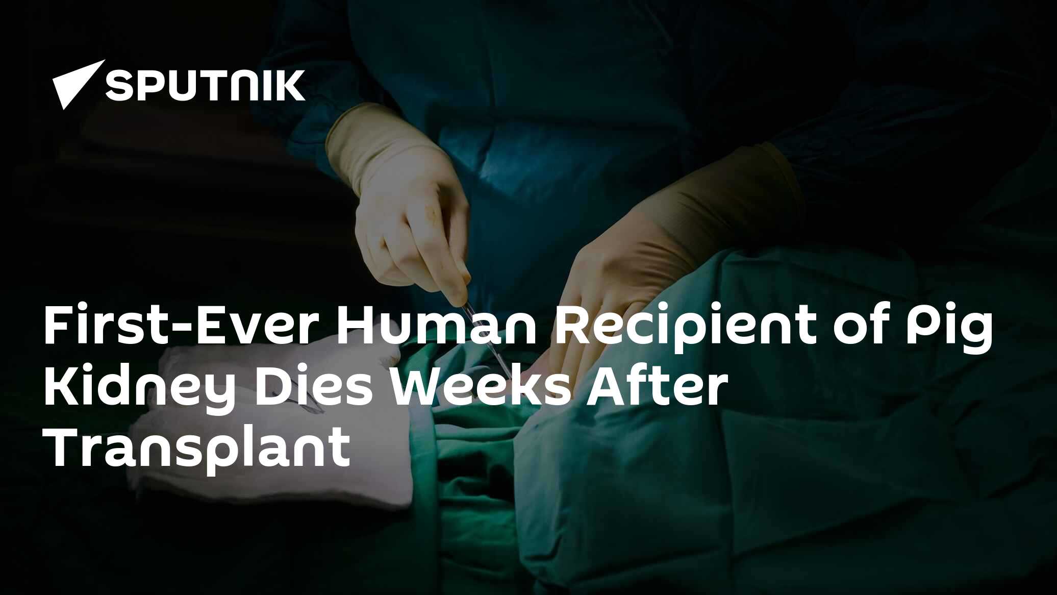 First-Ever Human Recipient of Pig Kidney Dies Weeks After Transplant