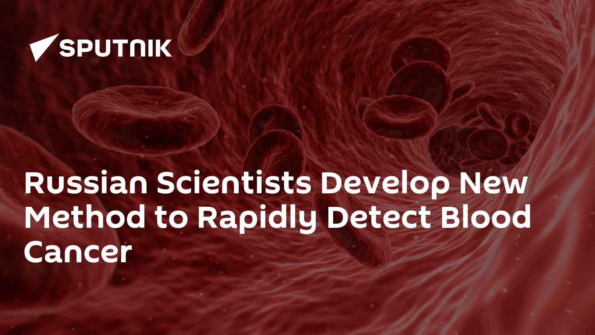 Russian Scientists Develop New Method to Rapidly Detect Blood Cancer