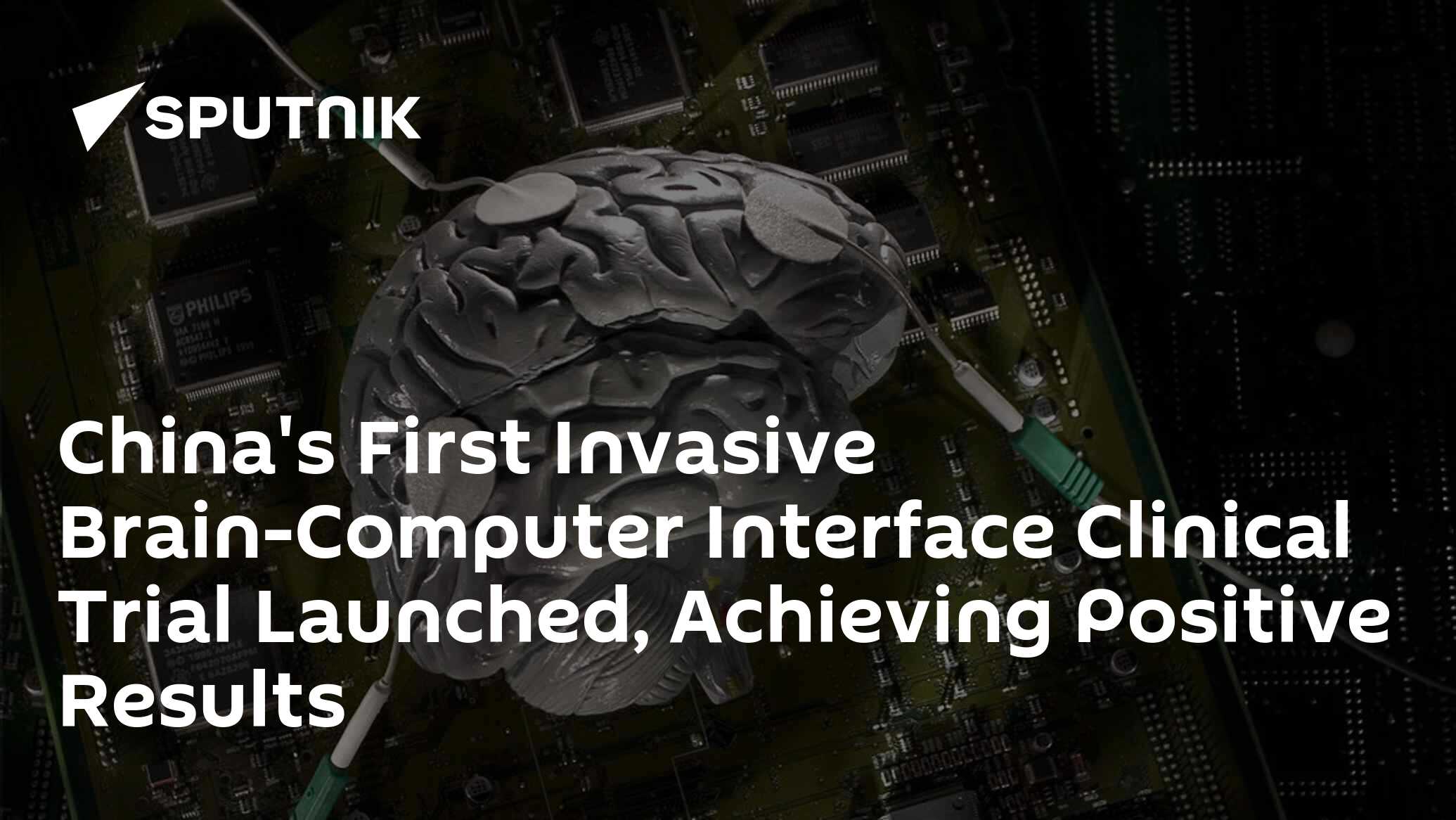China's First Invasive Brain-Computer Interface Clinical Trial Launched, Achieving Positive Results