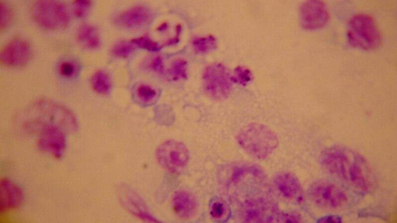 Indian Scientists Find Reason Behind Spread of Parasite Causing Black ...